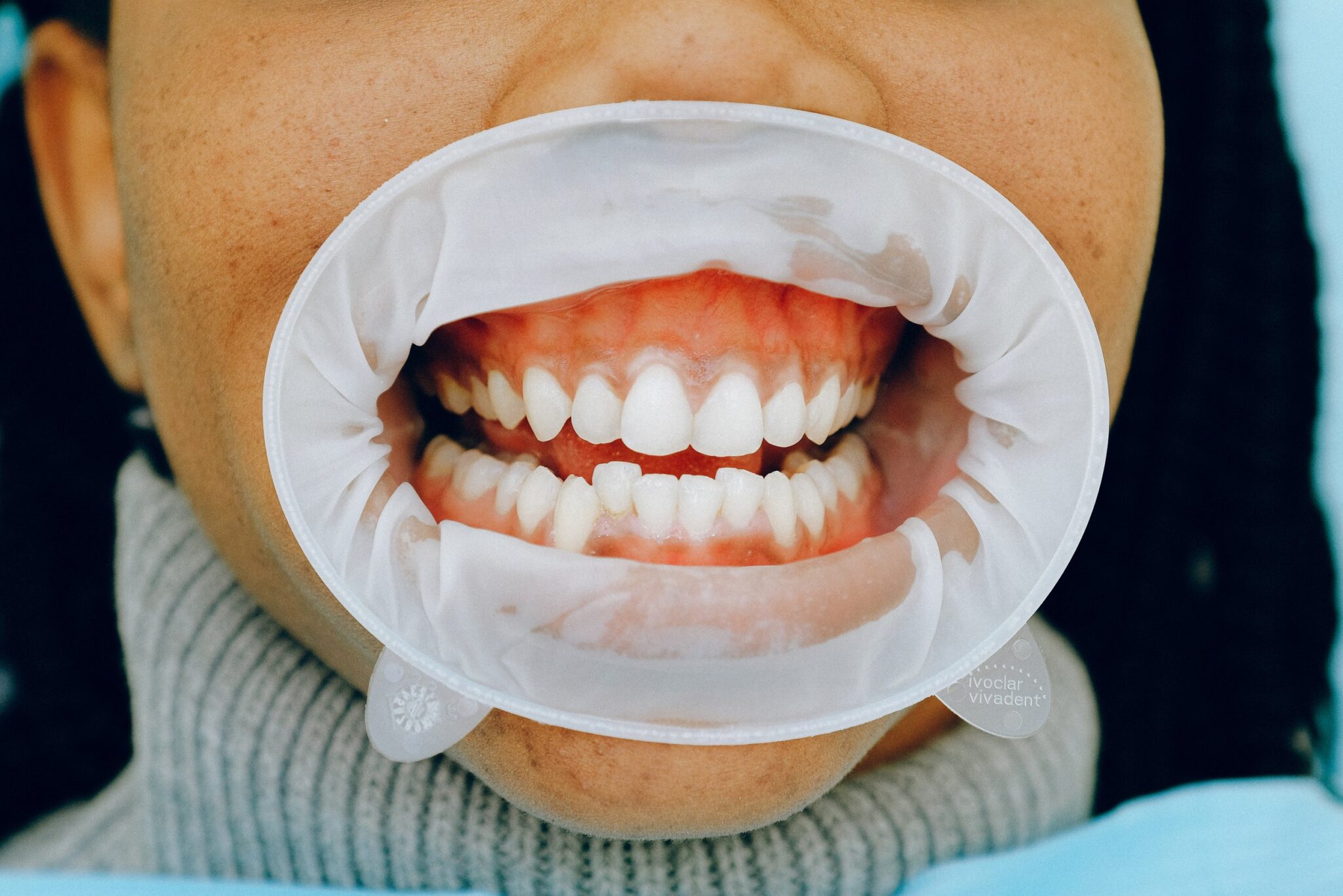 How to Use a Gum Stimulator – Trident Dental